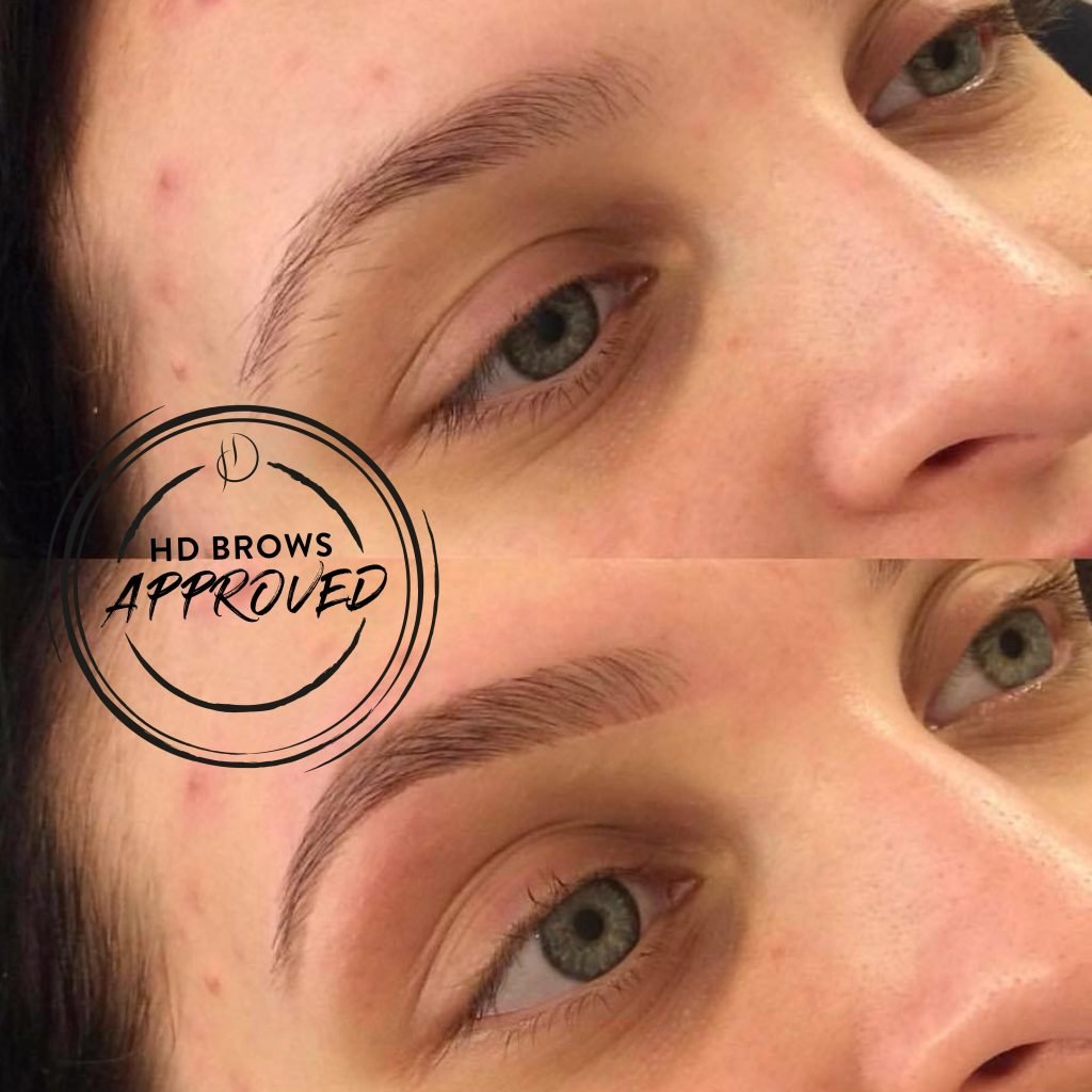 Eye & Brow Treatment - Skin Clinic Solutions